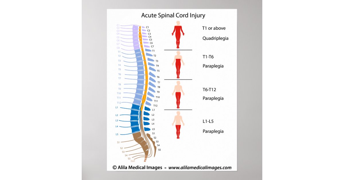 Spinal cord injury levels, labelled diagram. poster | Zazzle.co.nz